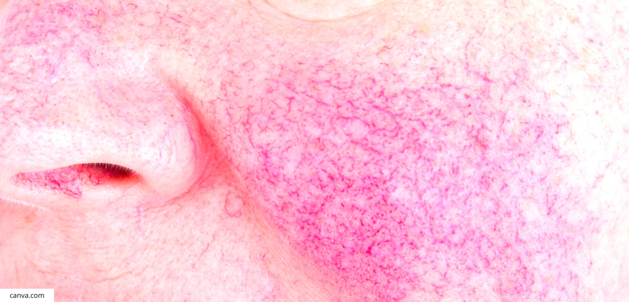 SKINCARE GURU: SKINCARE TIPS AND PRACTICES THAT COULD SAVE YOU WITH ...